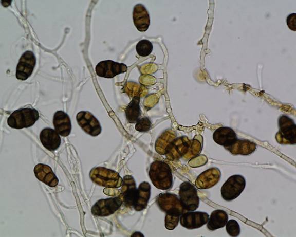 Pithomyces | Environmental Reporter