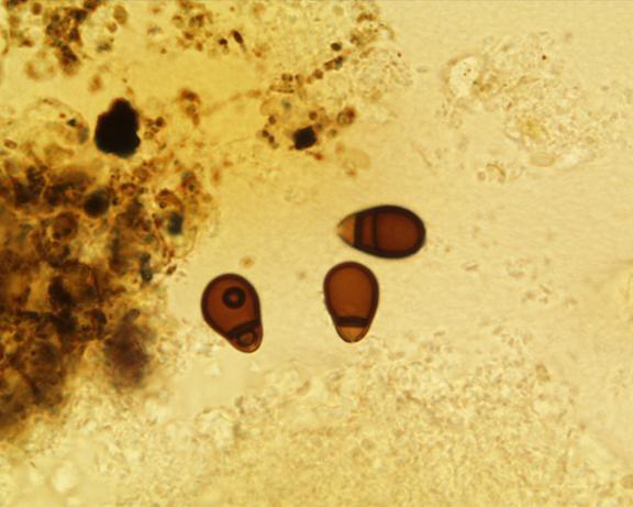 Trichocladium | Environmental Reporter